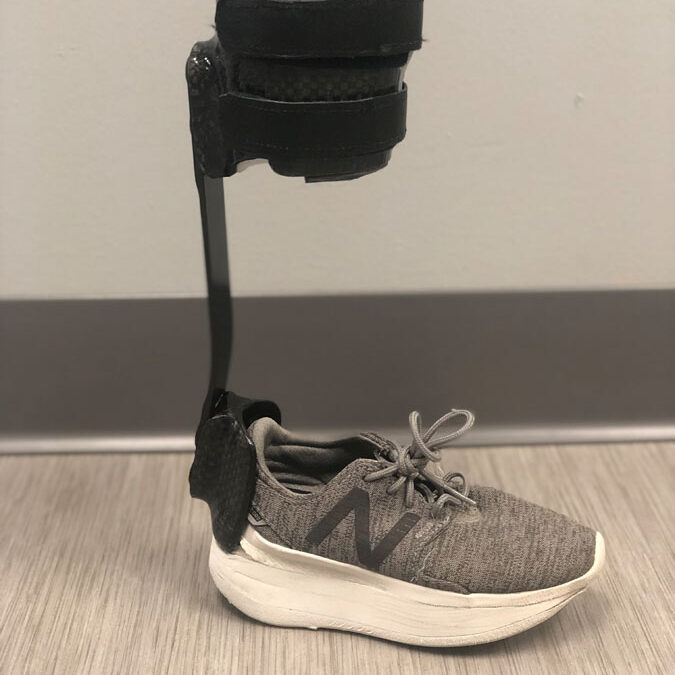 Partial Foot / Other Lower Limb Conditions (XOS) – Prosthetic ...