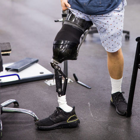 Patterson Propulsion Socket (PPS) – Prosthetic & Orthotic Associates