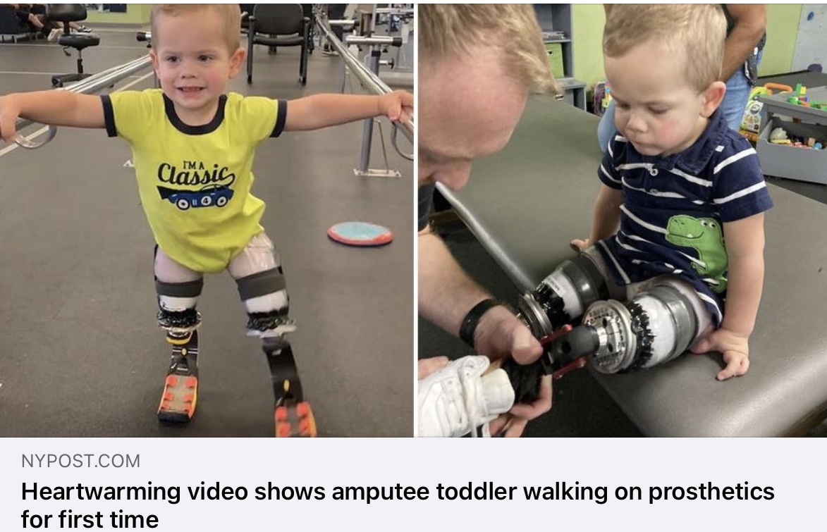 2-year-old Louie Walking for 1st Time on Two Prosthetic Legs ...